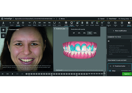 Invisalign Smile Architect™ – Najnowsze narzędzie dla stomatologów ...